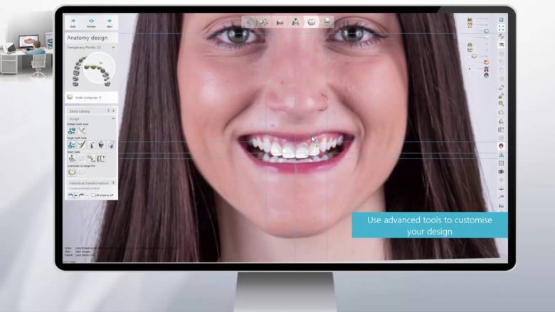Top 5 Digital Smile Design Software for Stunning Results